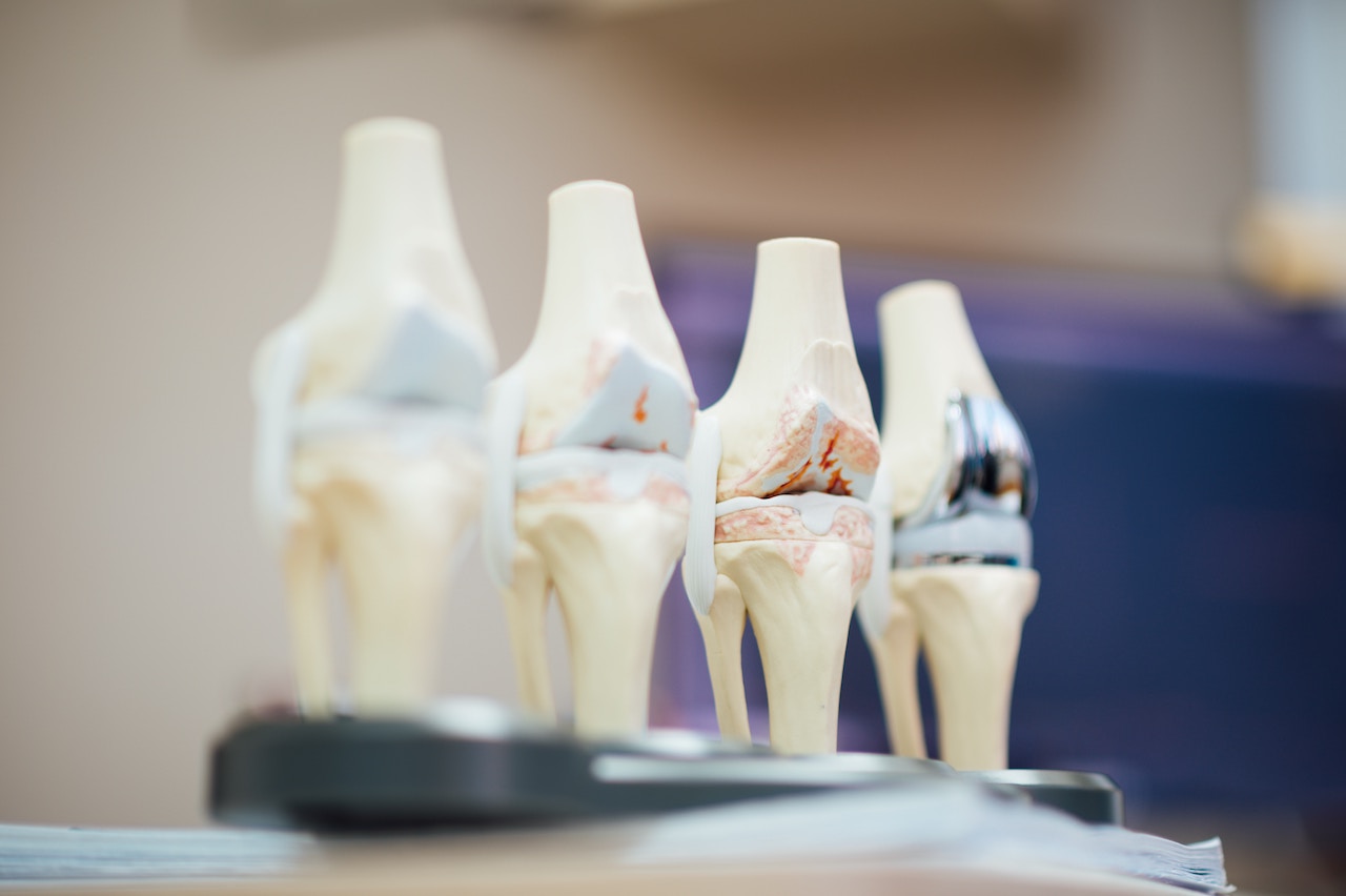 Preventing Joint Injuries with Proper Movement | REVIV Medical